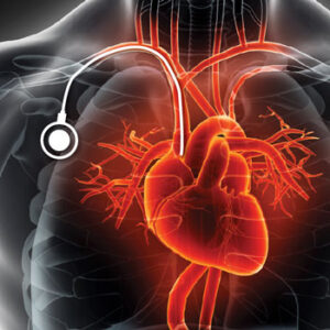 Port Placement & Removal - Houston - Synergy Vascular & Interventional